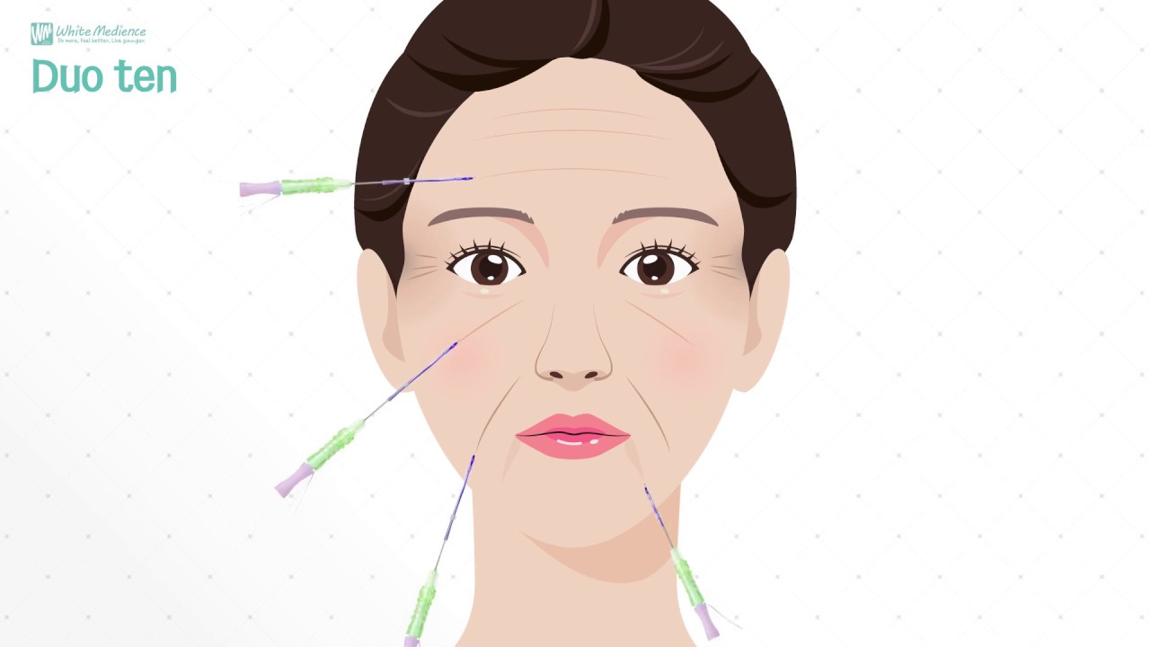 DUOTEN thread lifting (2D Animation) - White Medience - YouTube