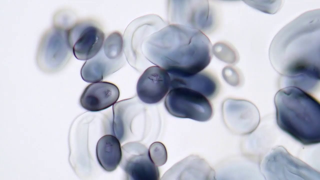 Potato Starch Under Microscope Advanced Microscopy Techniques For