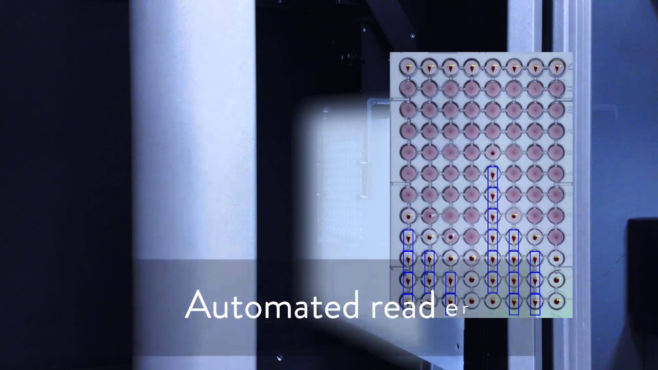 Microtechnix - HAI Test - YouTube