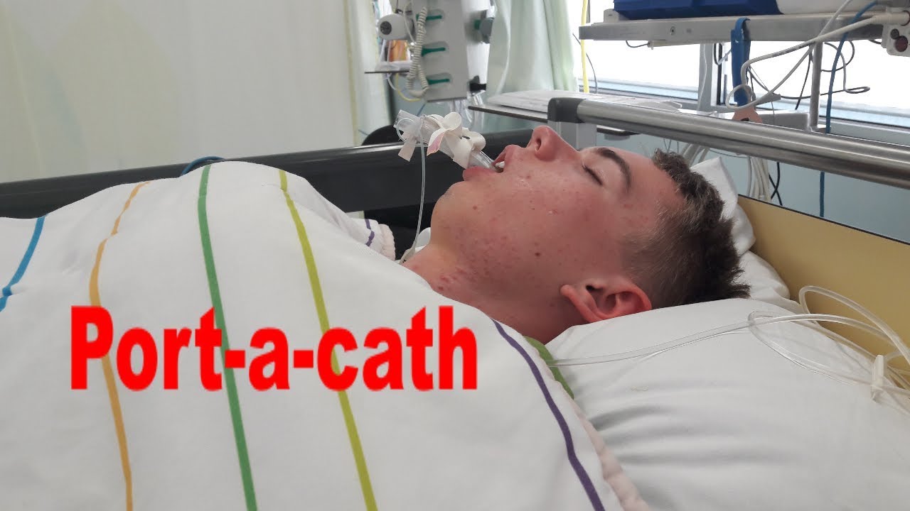 Operatie port-a-cath. - YouTube