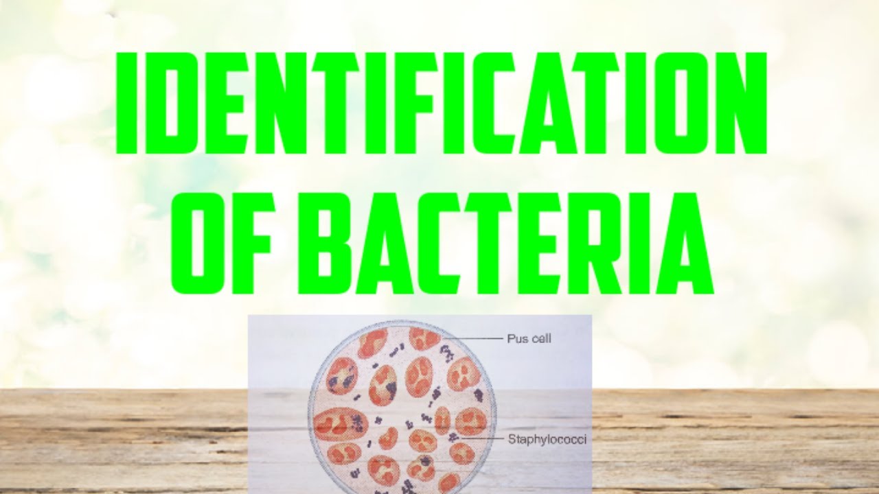 Identification of bacteria in microbiology || Short trick - YouTube