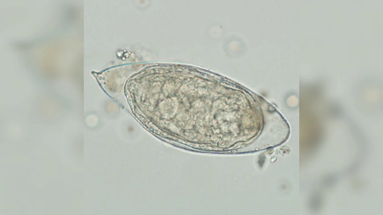 schistosoma haematobium under microscope x40 - YouTube