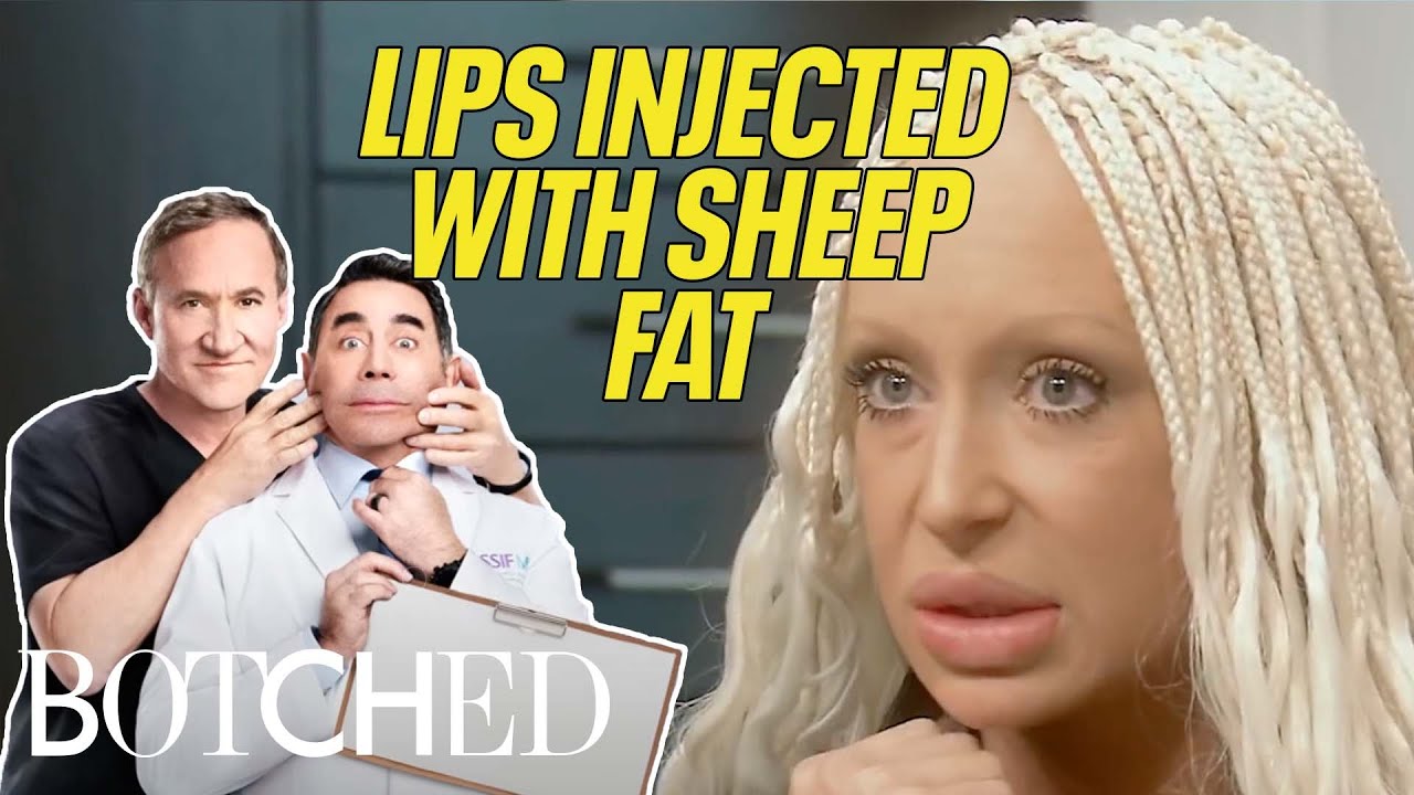 7 Botched Injection NIGHTMARES: Cement Injections, Sheep Fat ...