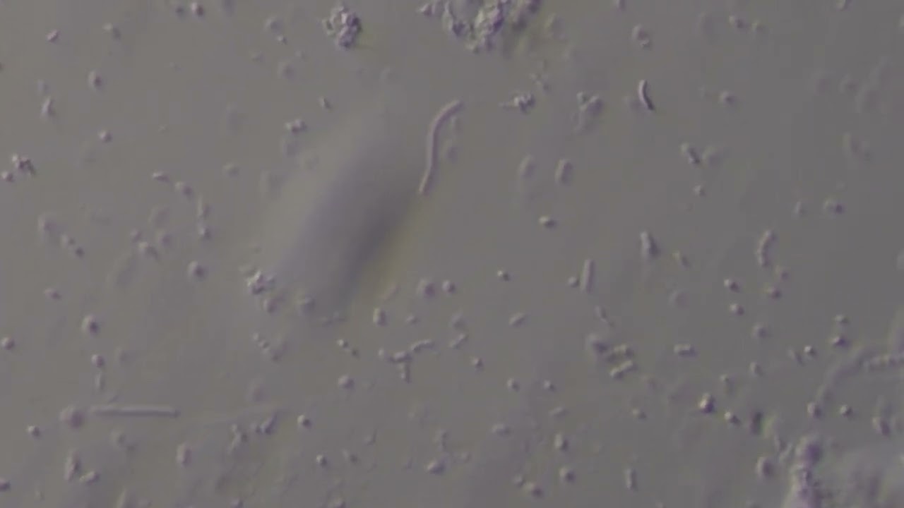 Yeast Cells Under Microscope 500x