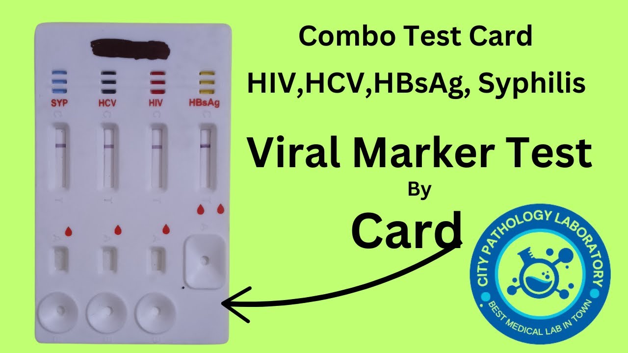 viral marker test | viral marking test | vdrl positive meaning | - YouTube