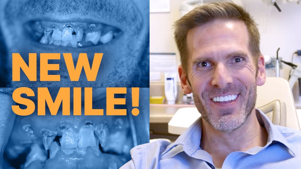 How My Smile Was Transformed After a Serious Injury - YouTube