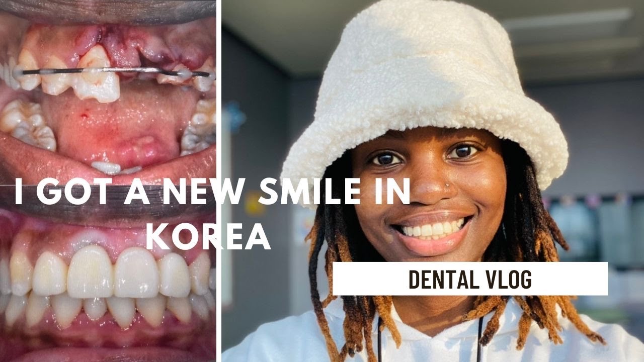 KOREA VLOG| Getting false teeth/ dentures and dental implants in Korea ...