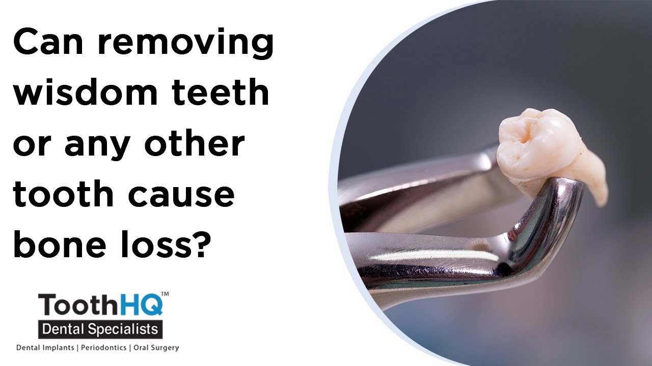 Can removing wisdom teeth or any other tooth cause bone loss? Dr ...