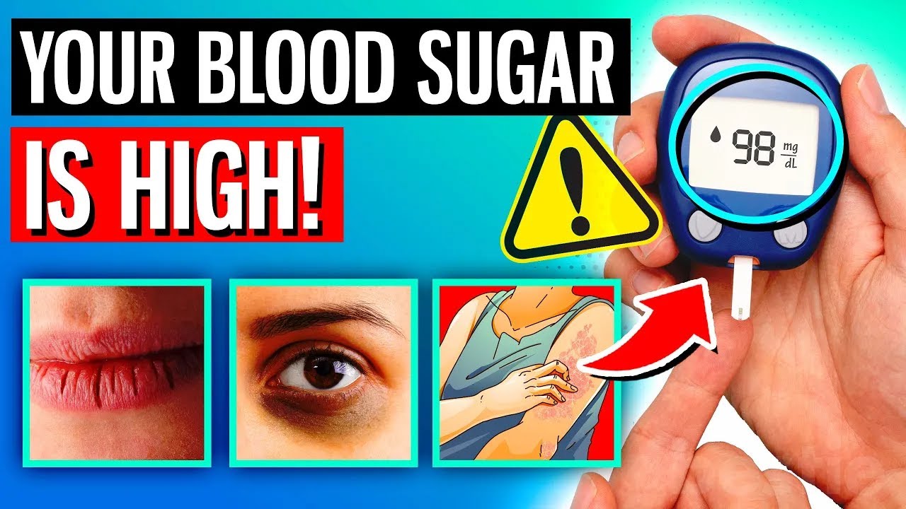12 WARNING Signs Your Blood Sugar Is Extremely High - YouTube