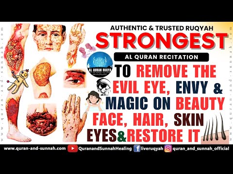 AL QURAN RUQYAH TO REMOVE THE EVIL EYE, ENVY & MAGIC ON BEAUTY, FACE, HAIR, SKIN, EYES & RESTORE IT.