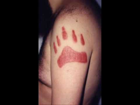 Examples of Hyfricater branding (scarification) - YouTube