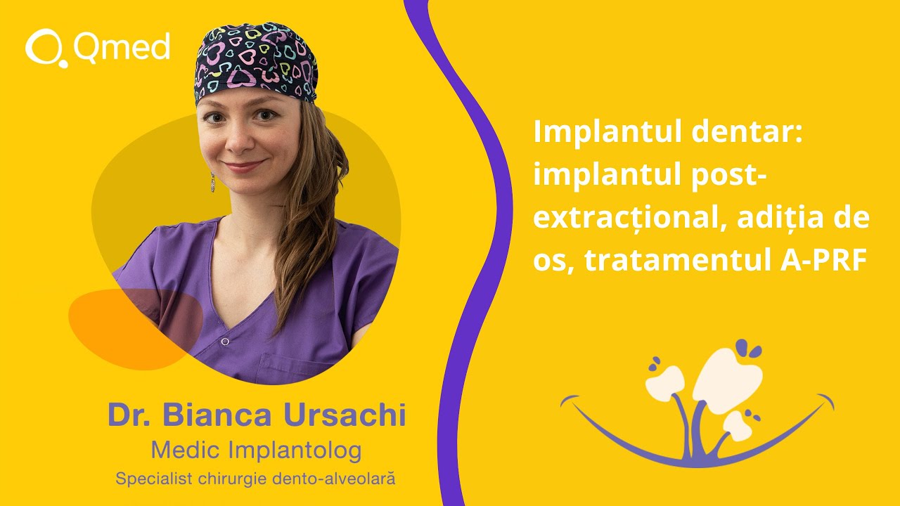 Despre implantul dentar - Dr. Bianca Ursachi Gălan, medic implantolog - YouTube