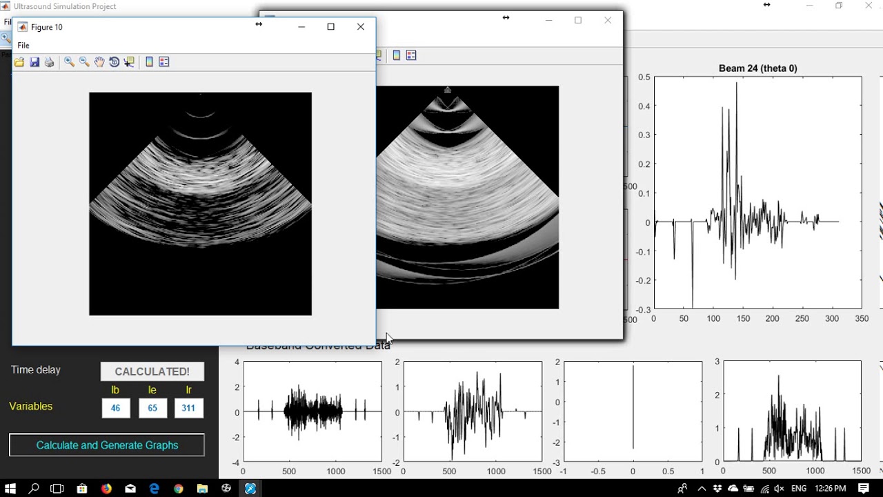 Ultrasound Simulation Application - MatLab - YouTube