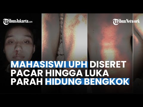 Viral Mahasiswi UPH Dianiaya Pacar hingga Luka Parah dan Hidung Bengkok, Korban Juga sempat Diseret