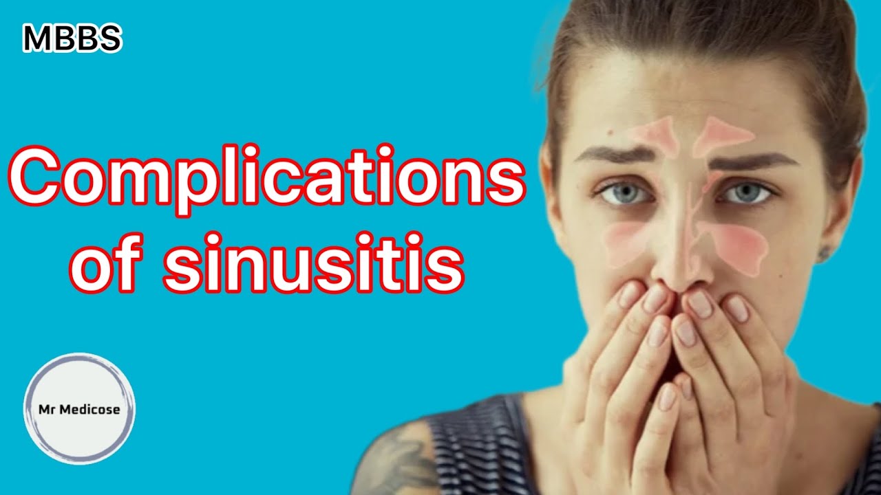 Complications of sinusitis | ENT nasal cavity - YouTube