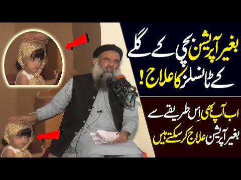 Tonsils Ka Bgair Operate Ilaj | Best Bayan by Dr Sharafat Ali | Latest HD Video