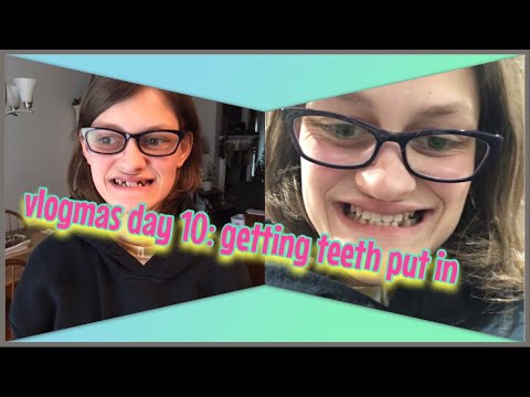 vlogmas day 10: getting teeth put in - YouTube