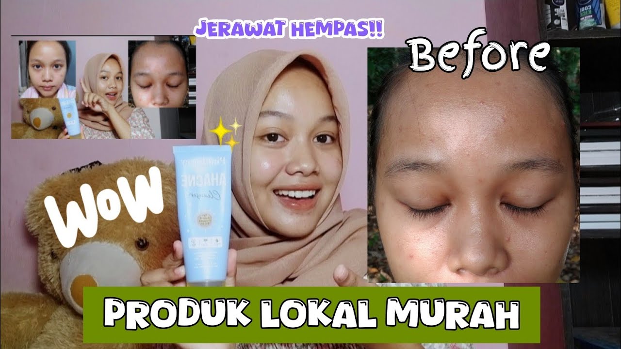review 2 produk skincare untuk menghilangkan jerawat‼️PAKE PRODUK LOKAL ...
