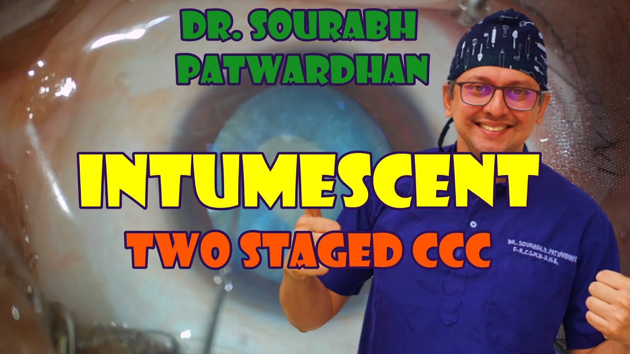 Two staged CCC for intumescent cataract Dr Sourabh Patwardhan - YouTube