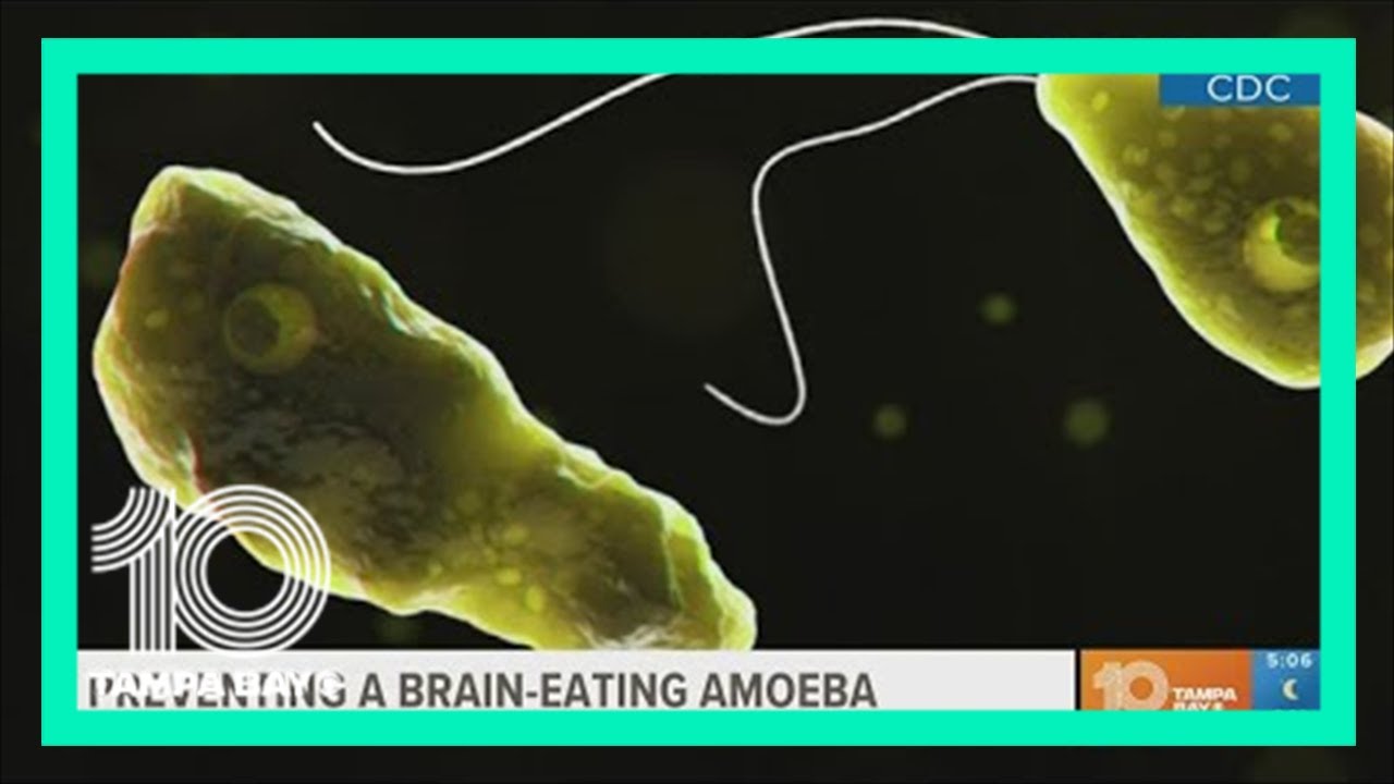 How to avoid brain-eating amoeba while swimming this summer - YouTube