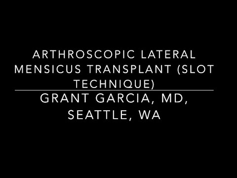 Step by step surgical video for a lateral meniscus transplant - YouTube