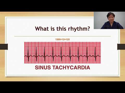 Advanced Life Support: Electrocardiogram Rhythm - YouTube