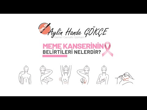 Doç. Dr. Aylin Hande GÖKÇE_Meme Kanserinin Belirtileri Nelerdir?