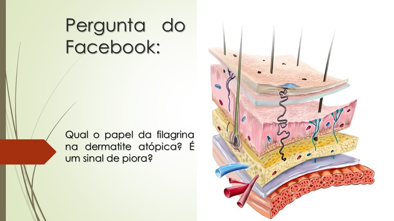 Qual o papel da filagrina na dermatite atópica? | É um sinal de piora ...