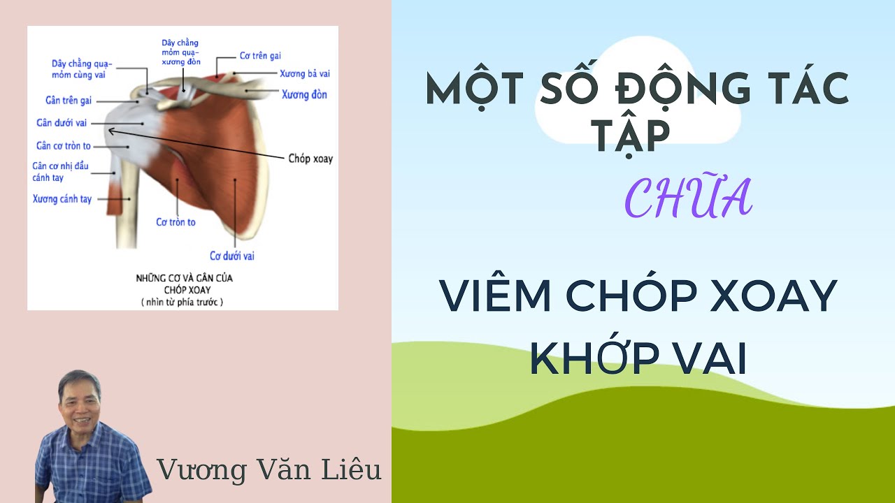 CHỮA VIÊM CHÓP XOAY KHỚP VAI - YouTube