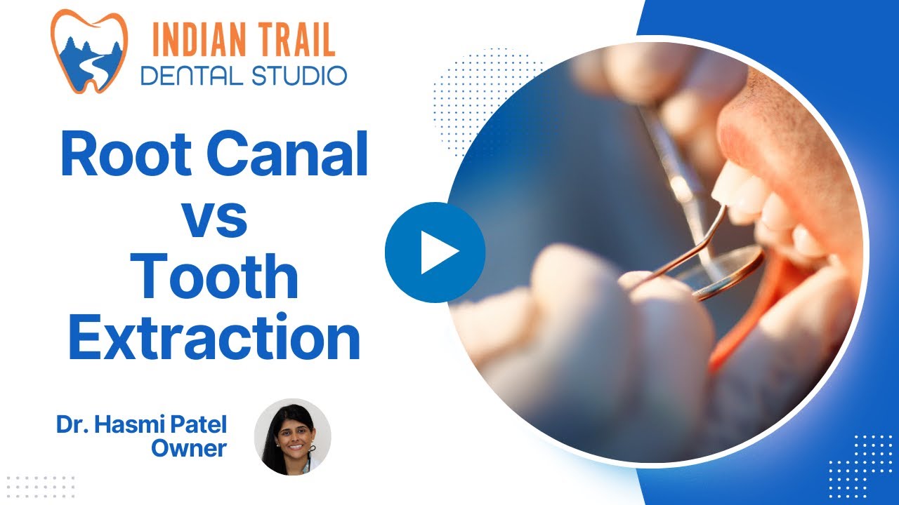 Root Canal vs Tooth Extraction: Which Is Better? | Indian Trail Dental ...