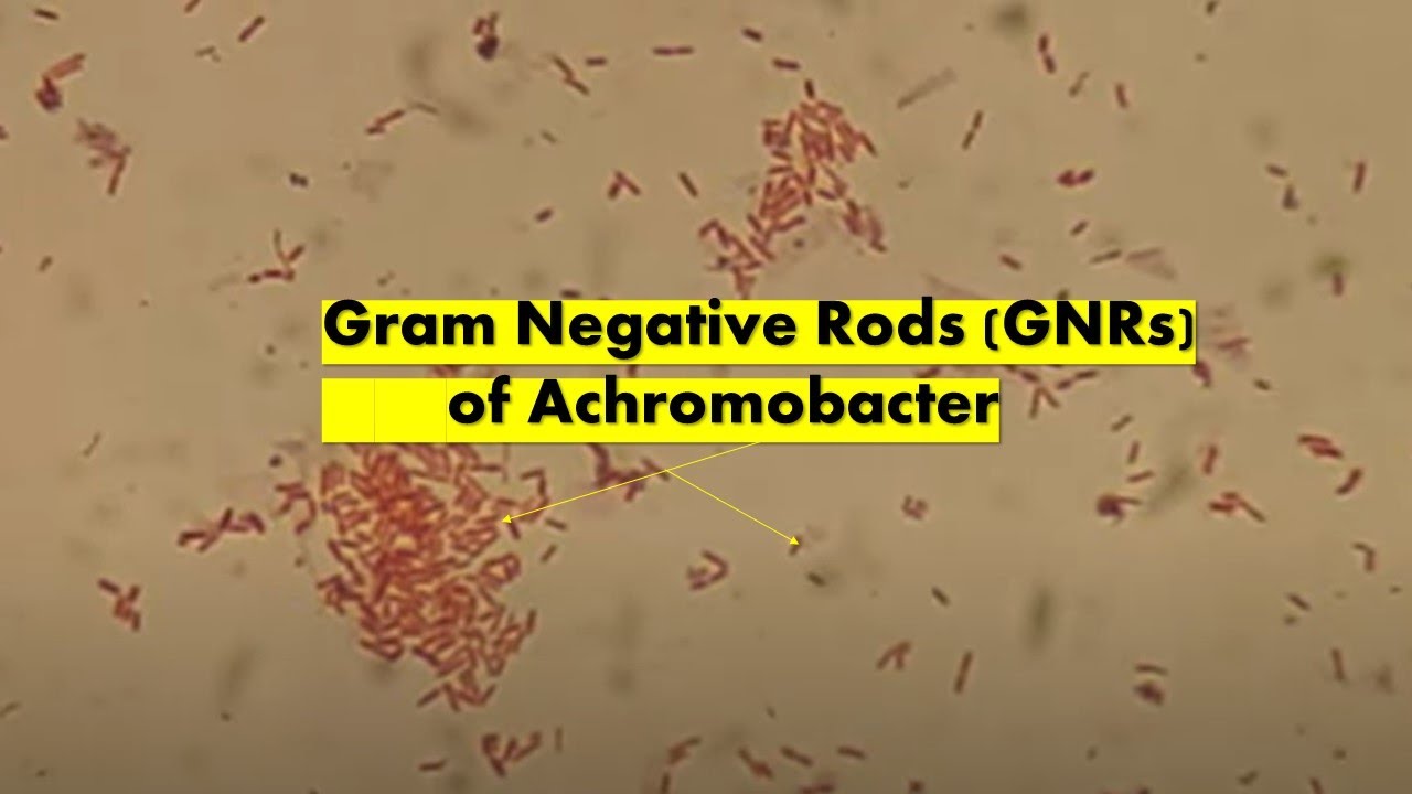 Gram Negative Rods