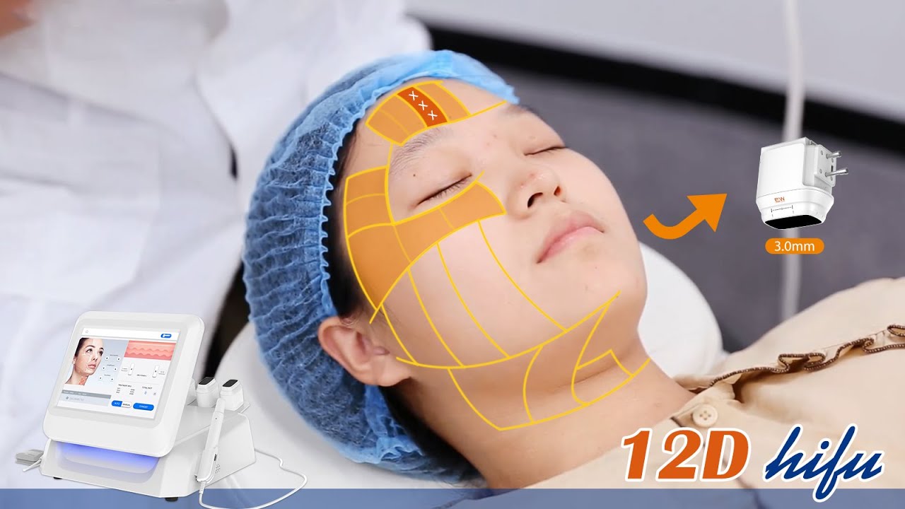 Newangie®12D hifu machine operation and treatment video FU4-1S # ...
