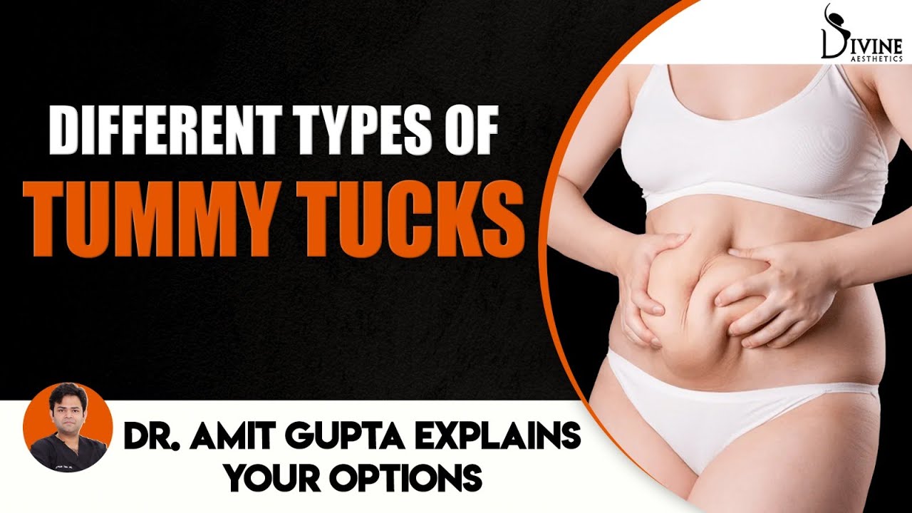 Different Types of Tummy Tucks: Dr. Amit Gupta Explains Your Options ...