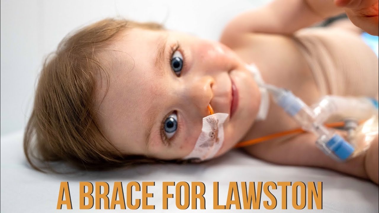 The Art & Science of Orthotics: Building a Custom Brace for Omphalocele ...