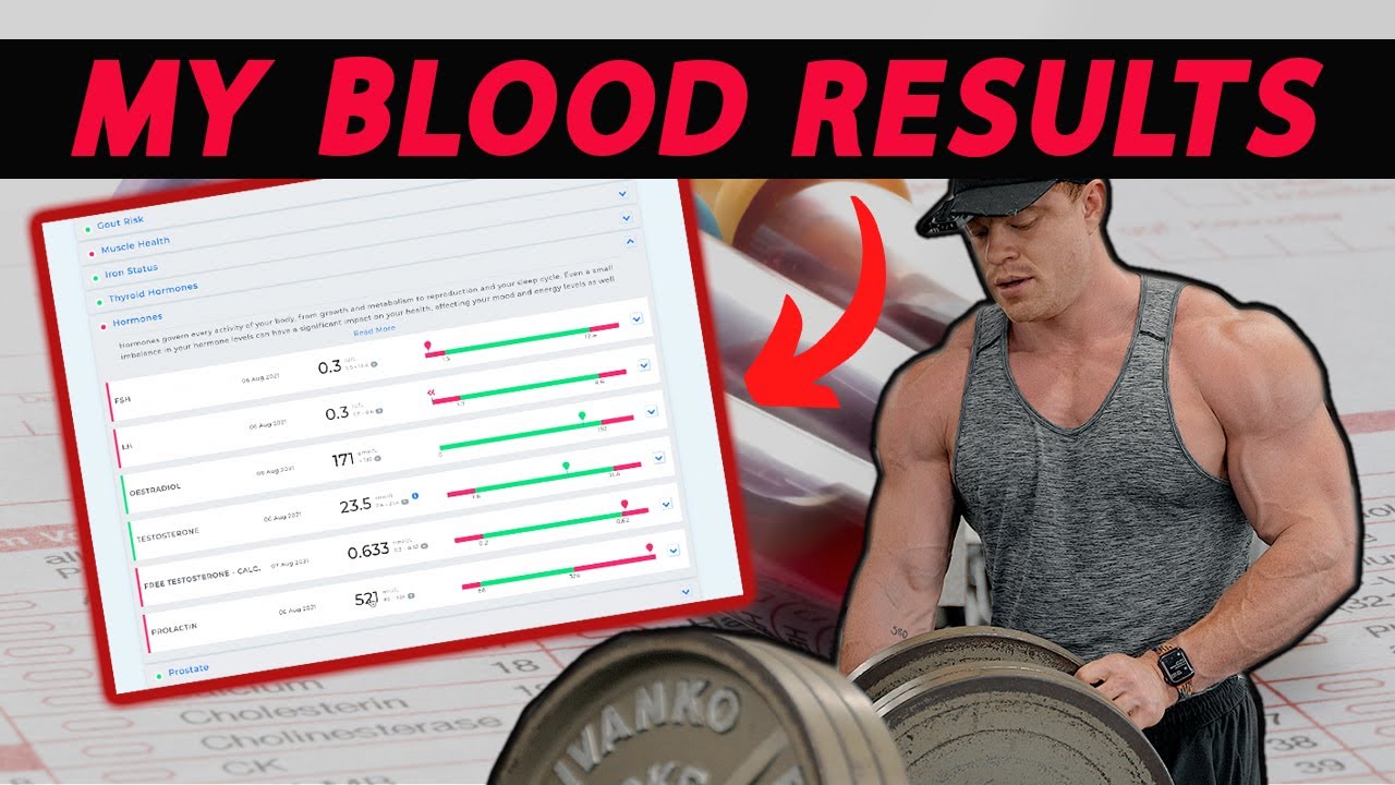 My FULL Bloodwork AFTER Using Steroids | Pro Bodybuilder - YouTube