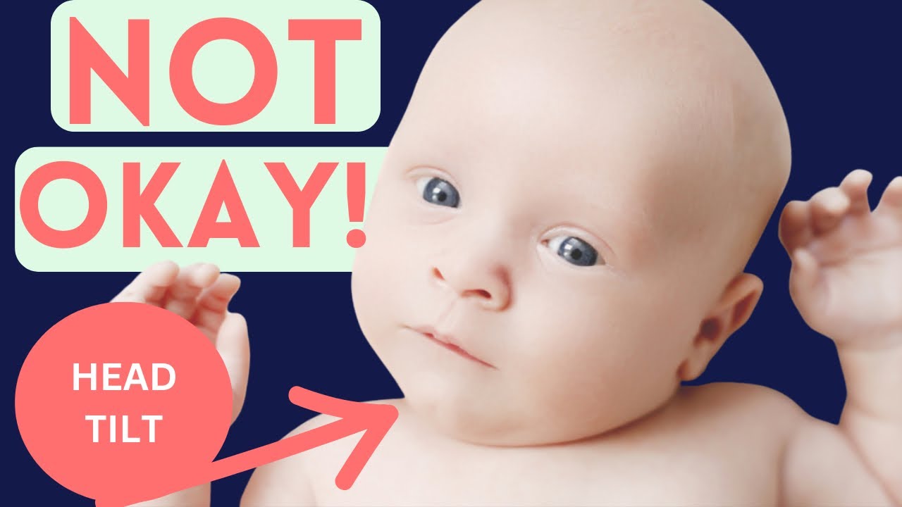 BEWARE of this baby head tilt (baby torticollis) OT discusses what ...