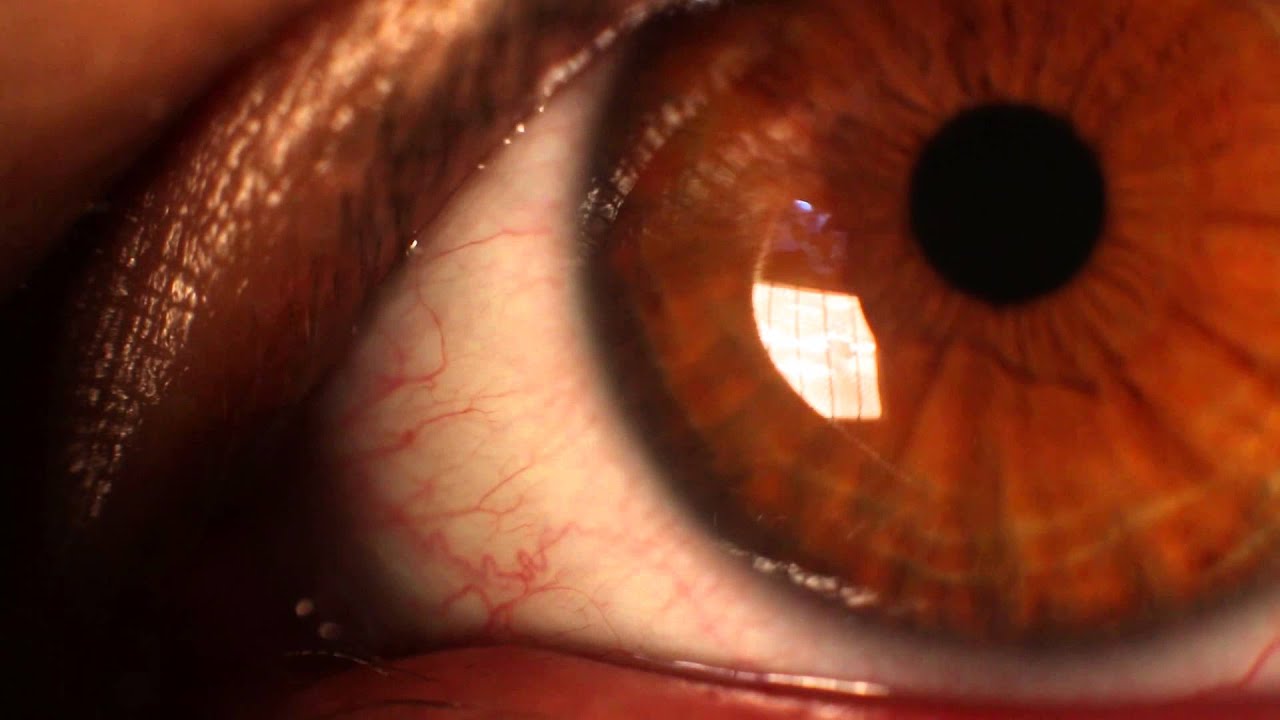 Ojo parpadeando - Blinking eye! - YouTube