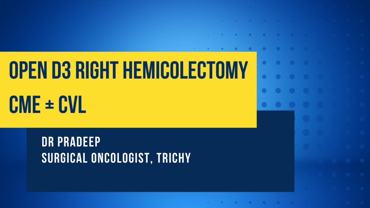 Open D3 Right Hemicolectomy | CME + CVL | Dr Pradeep | Surg Onco - YouTube