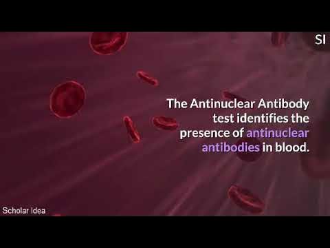 What is Antinuclear Antibody (ANA) test? - YouTube
