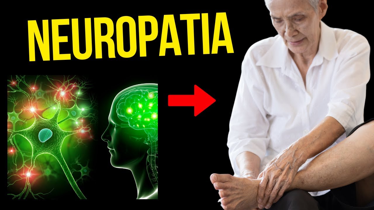 Todo sobre la NEUROPATÍA PERIFÉRICA (DAÑO NERVIOSO): Causas, Síntomas y ...