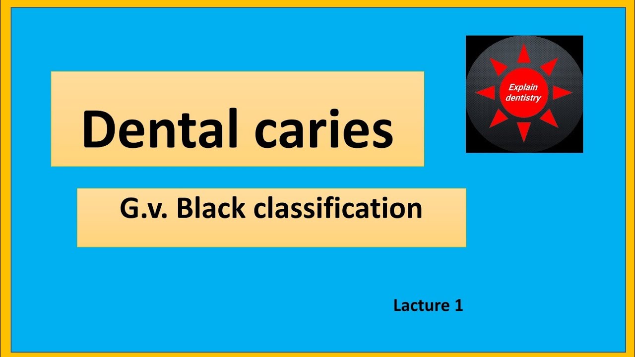 GV black Classification of dental caries //By dr vikash// - YouTube