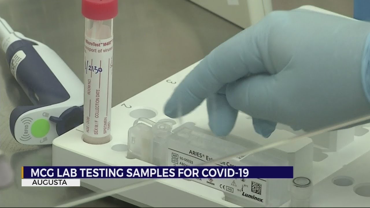 MCG at AU testing samples for COVID-19 - YouTube