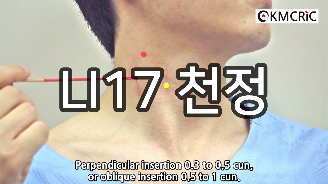LI17 천정 天鼎 Tianding (Eng sub) - KMCRIC WHO Standard acupoint DB - YouTube