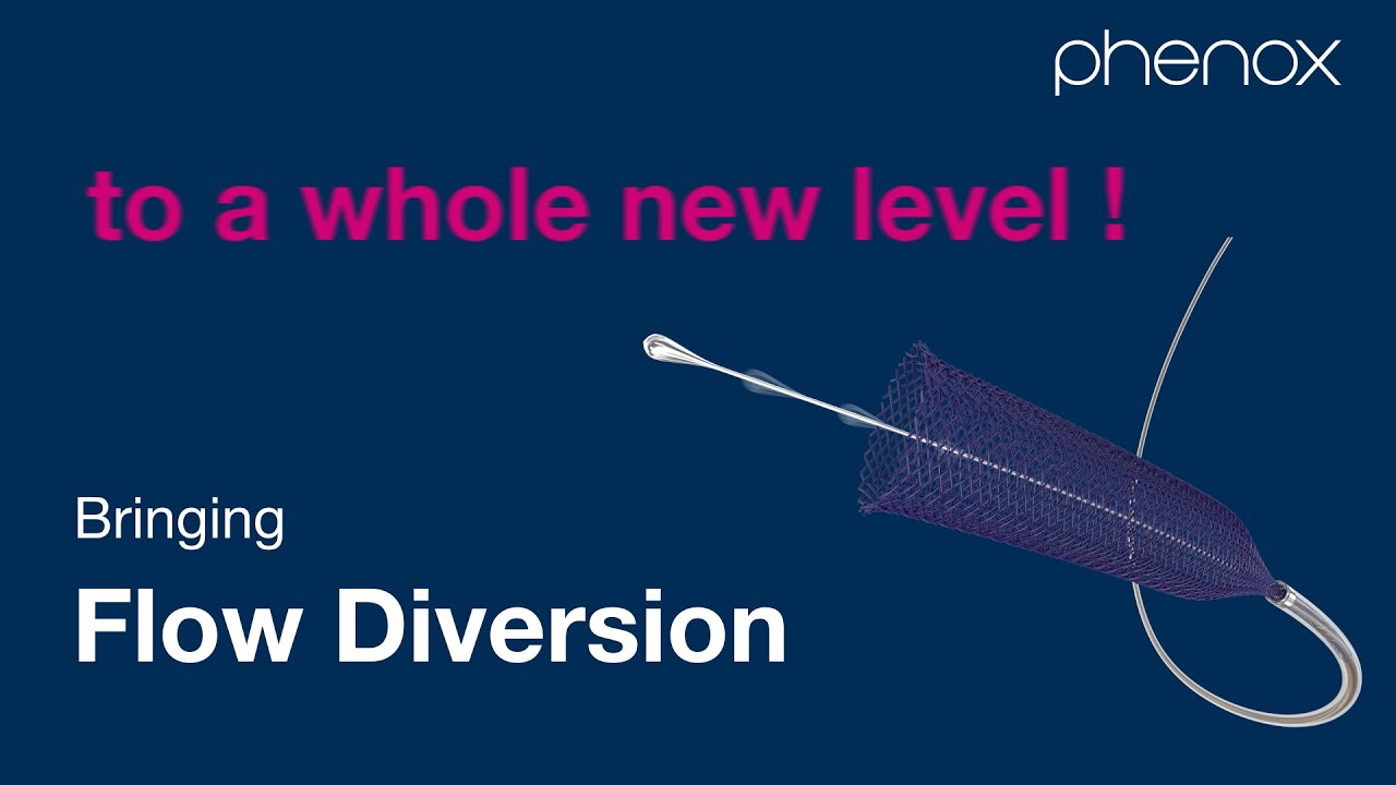 phenox | Promotional Video | p48 MW & p64 MW Flow Modulation Device | Available with HPC ...