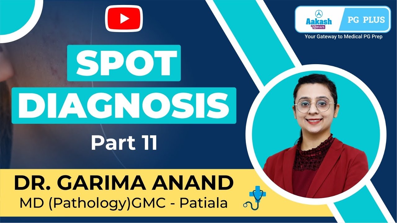 Spot Diagnosis - Part 11 by Dr. Garima Anand, Pathology Specialist | Aakash PG Plus - YouTube