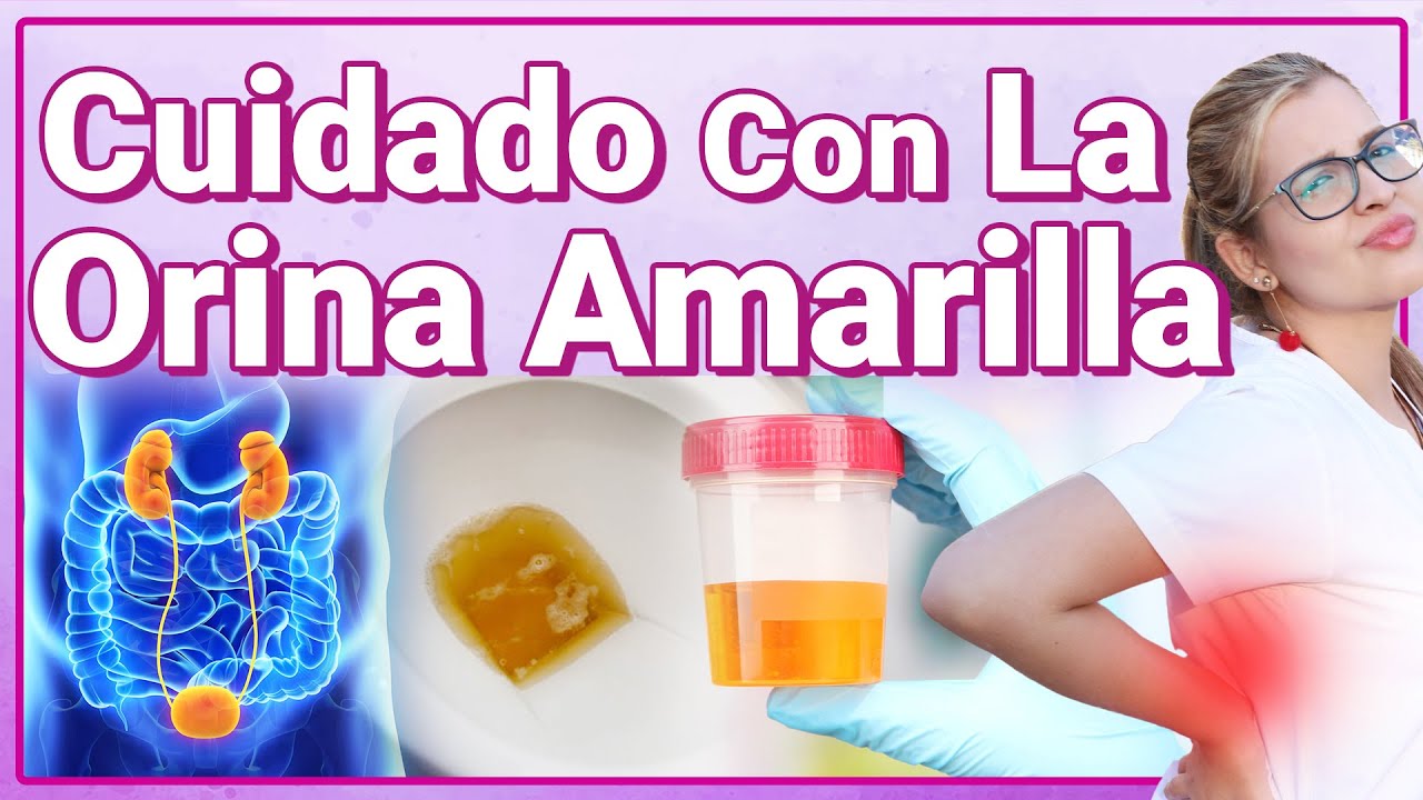 Qué Significa La Orina Amarilla - Enfermedades Que Producen Orina ...