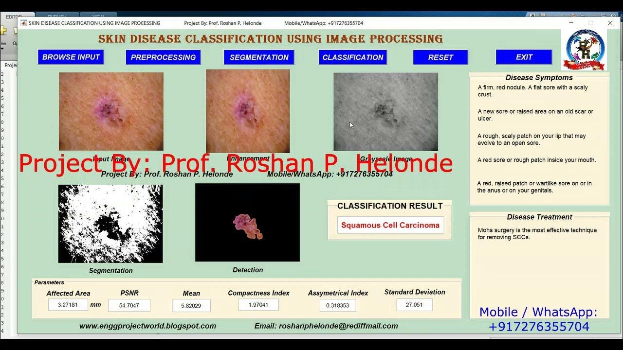 Skin Disease Detection Symptoms and Treatment Suggestion With Source ...