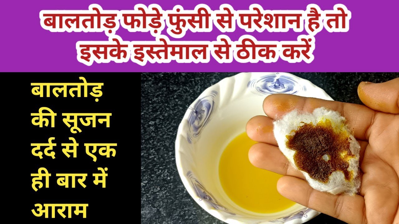 बालतोड़ फोड़े फुंसी को जल्द से जल्द ठीक करने का आसान उपाय, baltod ka ...