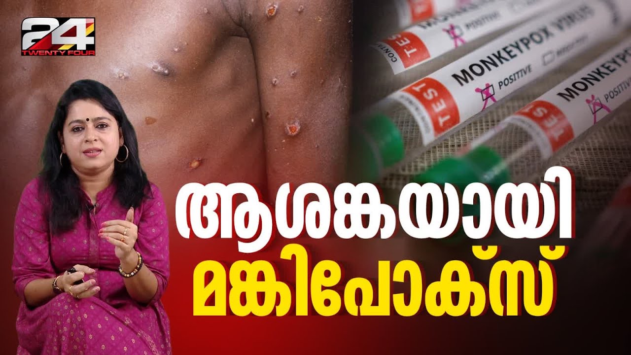 ആശങ്കയായി മങ്കിപോക്സ് ; പരിശോധന കർശനമാക്കി കേന്ദ്രം | Monkeypox | Explainer - YouTube