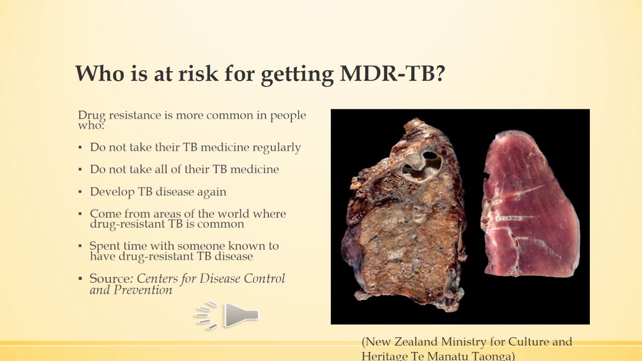 MDR TB slide show - YouTube